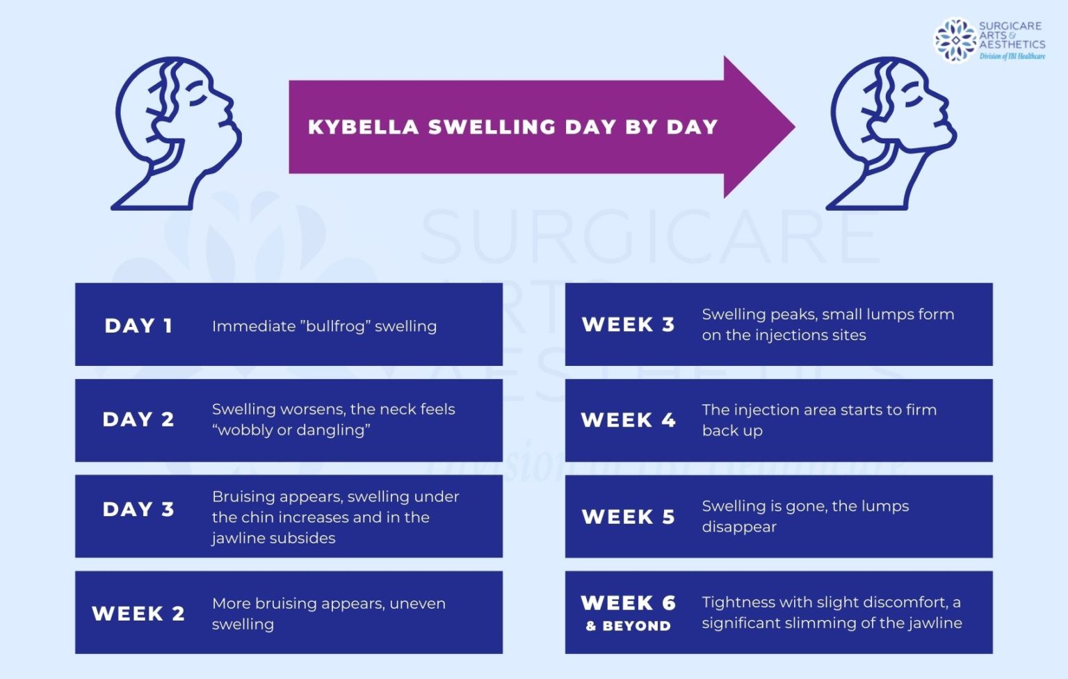Kybella Swelling Day By Day & How to Reduce Swelling